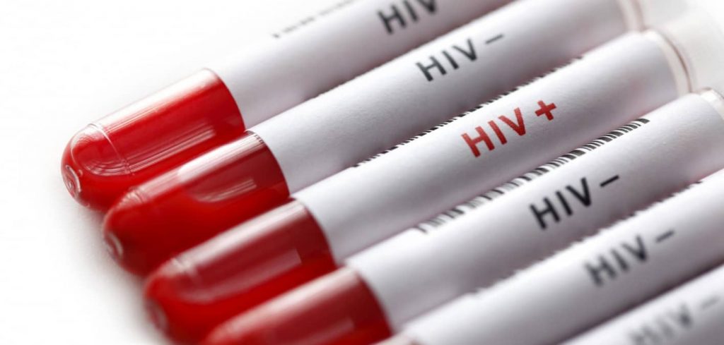 Quali sono i campanelli d'allarme dell'HIV? Quali sono i campanelli d'allarme dell'HIV?