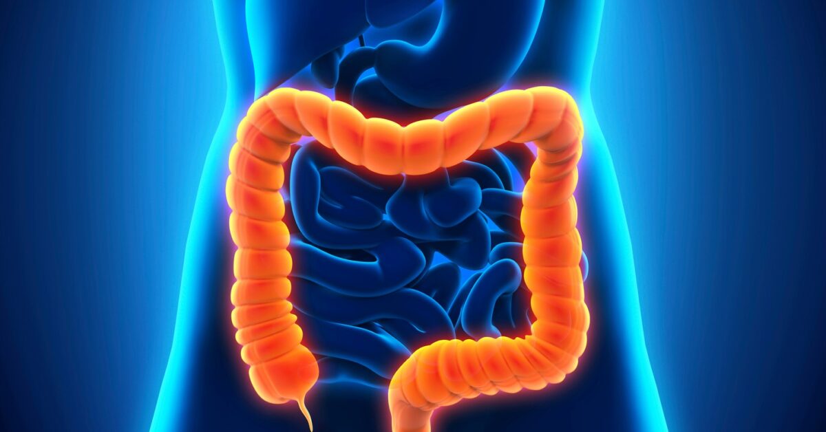 6 sintomi che possono indicare un problema al colon (anche grave)