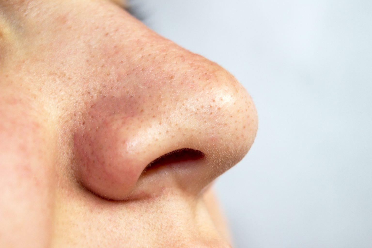 I peli dal naso vanno strappati?