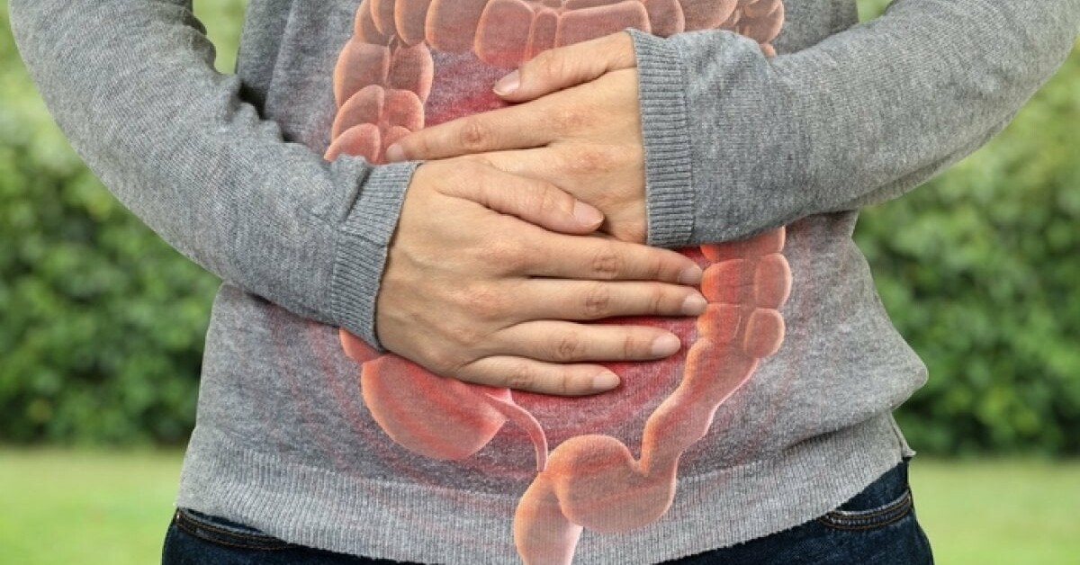 Cancro al colon: cos'è, sintomi, diagnosi, trattamento