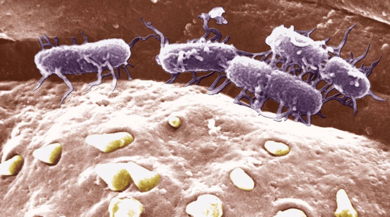 Febbre tifoide: cos'è, sintomi e trattamento