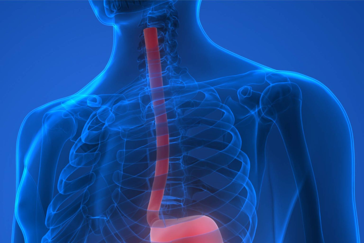 Cancro all'esofago: quali sono i campanelli d'allarme? La lista da ...