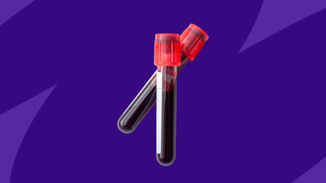 Emocromo completo: cosa comprende? Quello che devi sapere