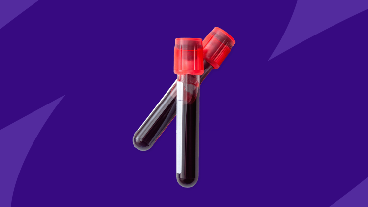 Emocromo completo: cosa comprende? Quello che devi sapere