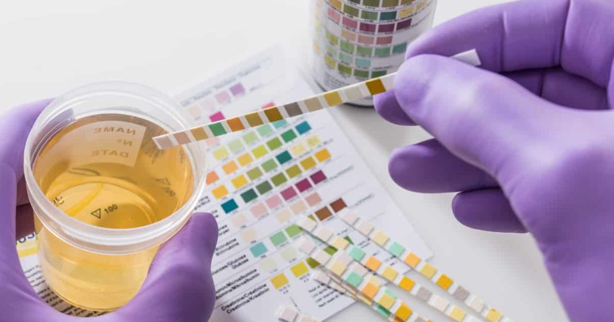 Perché l'urina è di colore giallo? Lo sai?