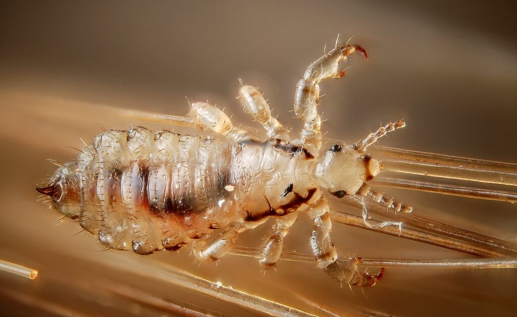 I pidocchi nascono dalla sporcizia?