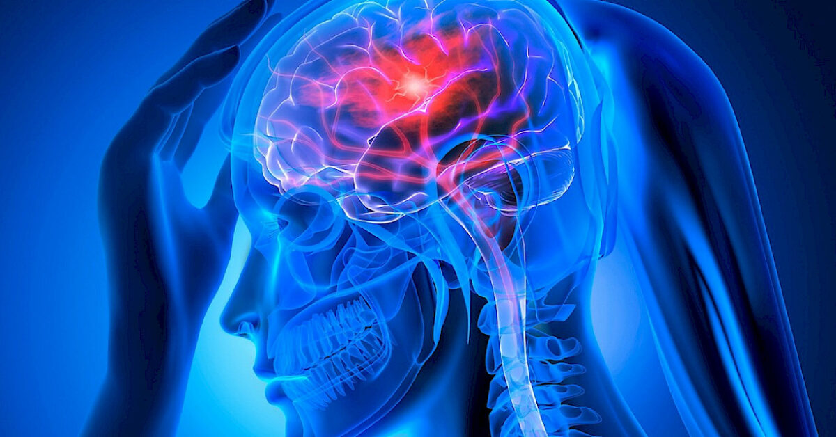Aneurisma: quali sono i sintomi premonitori