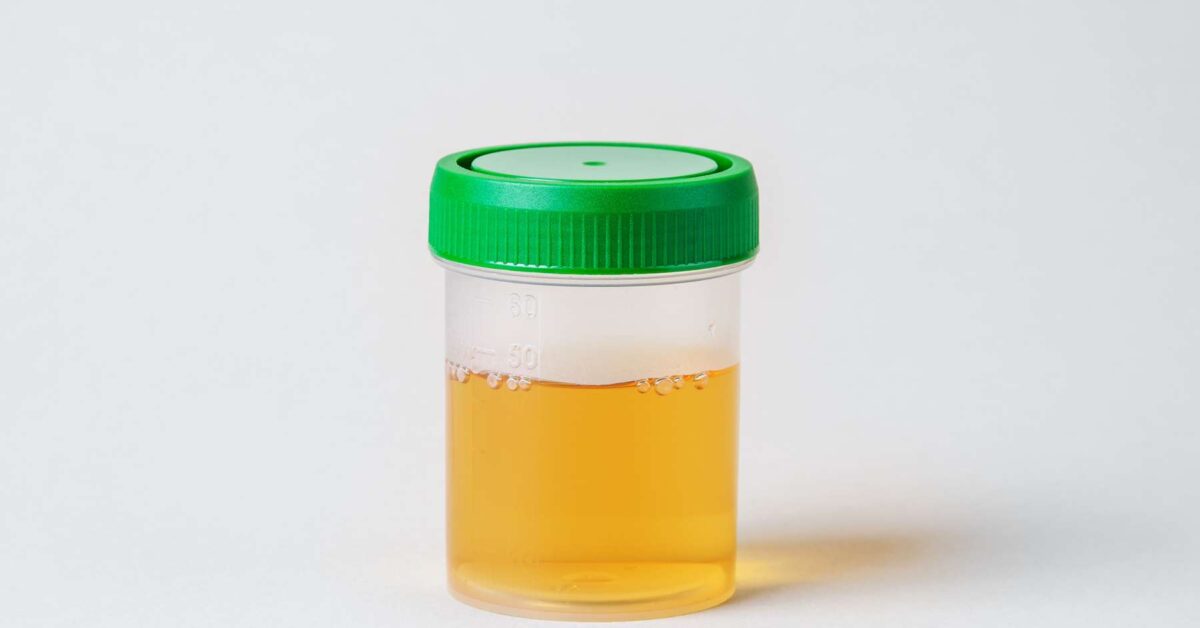 Ti sei mai chiesto perché la pipì è gialla?