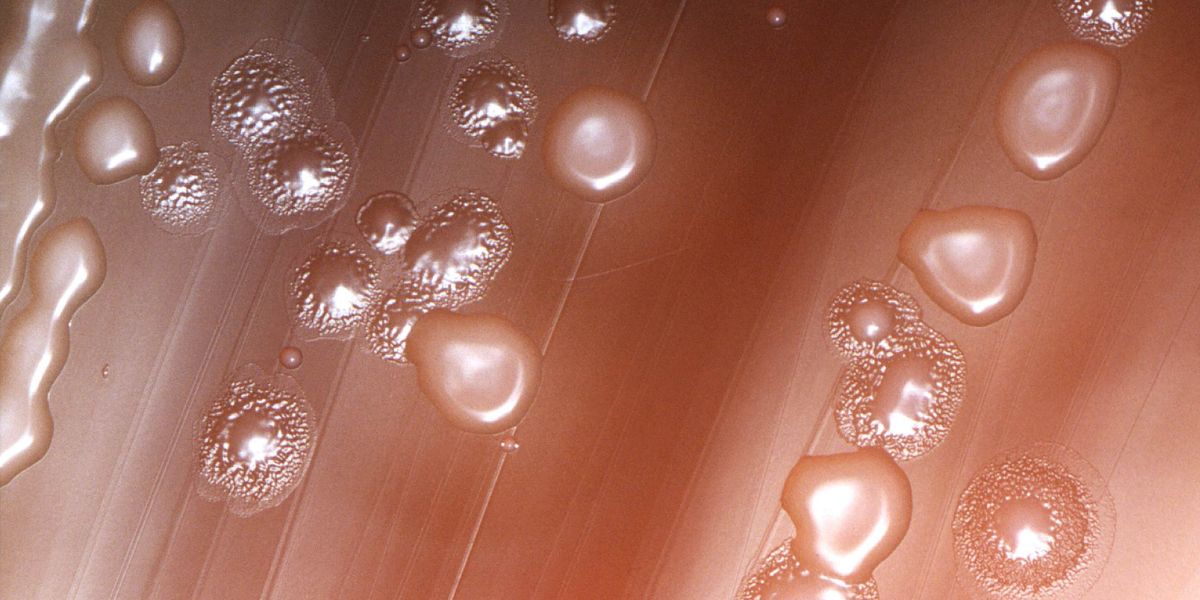 Streptococco: quali sono i sintomi e come si cura