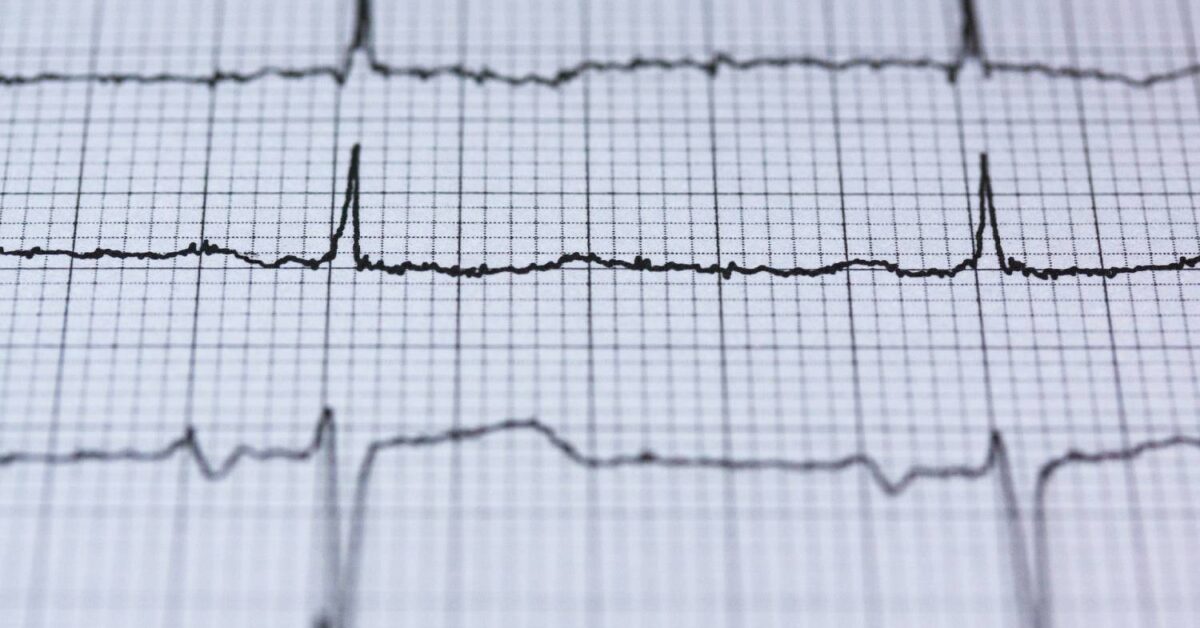 Fibrillazione atriale: cos'è e i campanelli d'allarme