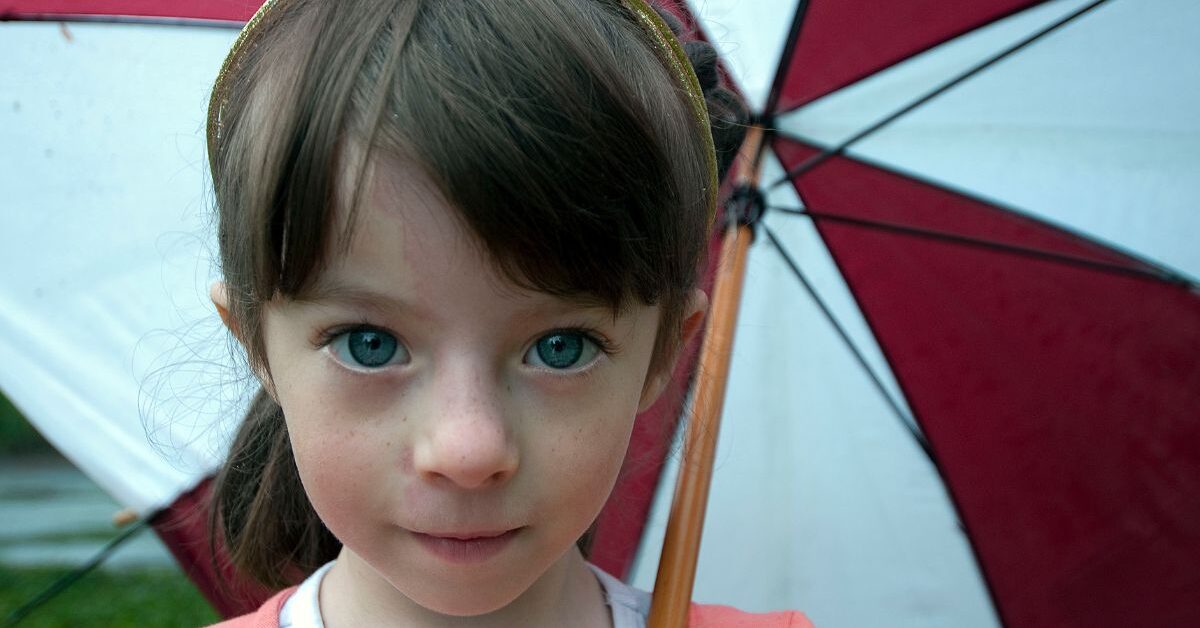 Mai sentito parlare della Sindrome di Silver Russell? Purtroppo non ...