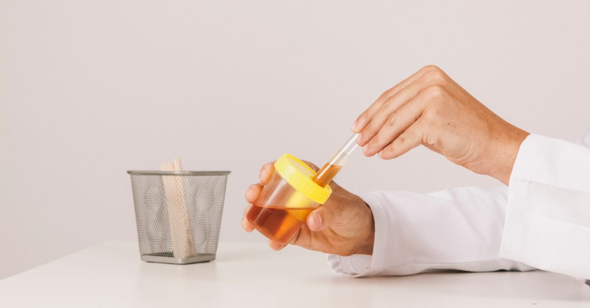 Cosa significa se hai i nitriti nelle urine?