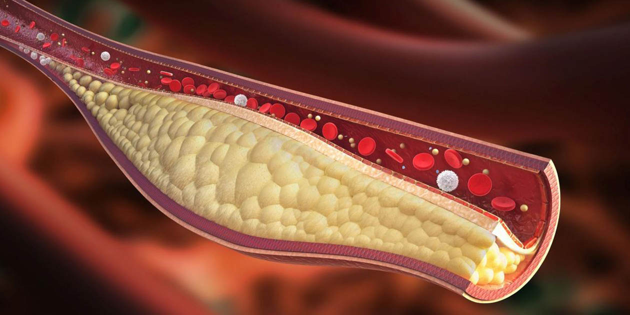 Il colore del muco può svelare molto sulla tua salute: ecco cosa sapere