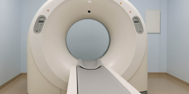 I tuoi reni funzionano bene? Controlla se hai questi 10 segni